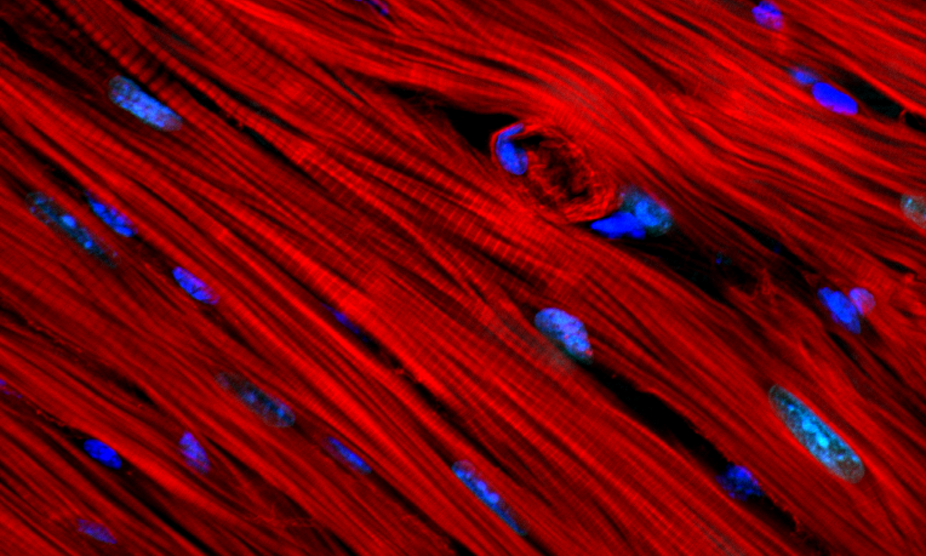 The Conversation: Mechanical forces in a beating heart affect its cells ...