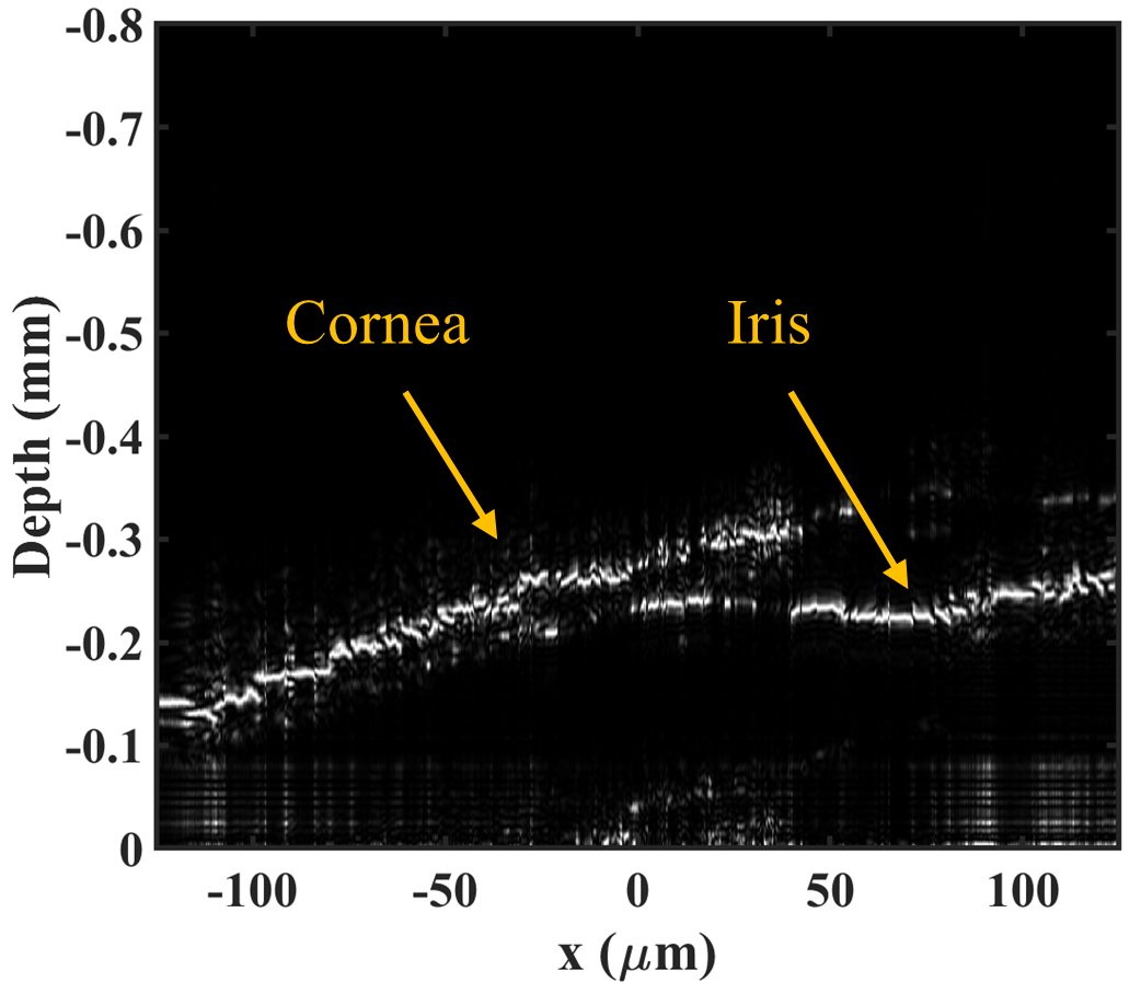 New bioimaging device holds potential for eye and heart condition ...