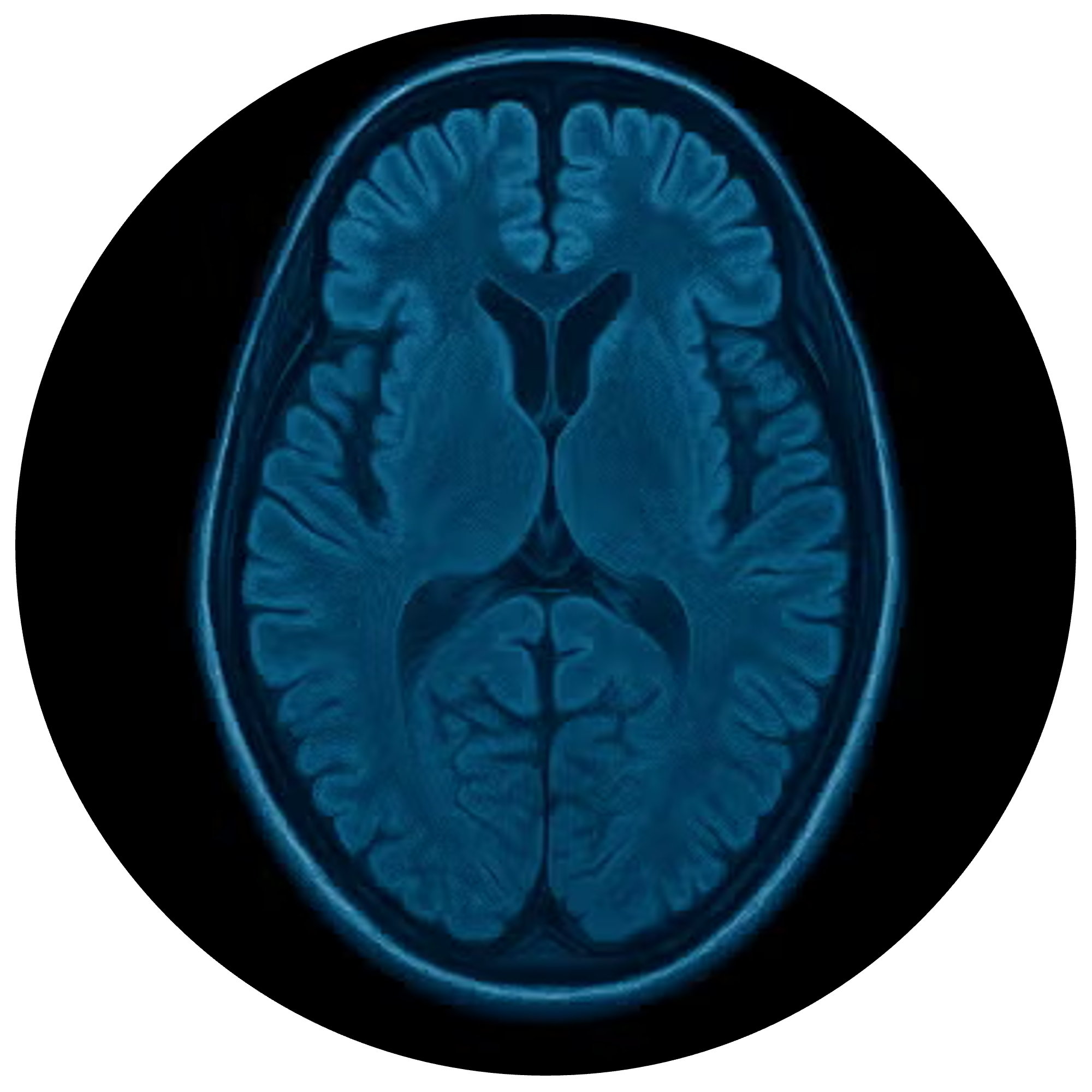 New Neuroscience BS degree announced by CU Boulder’s College of Arts ...