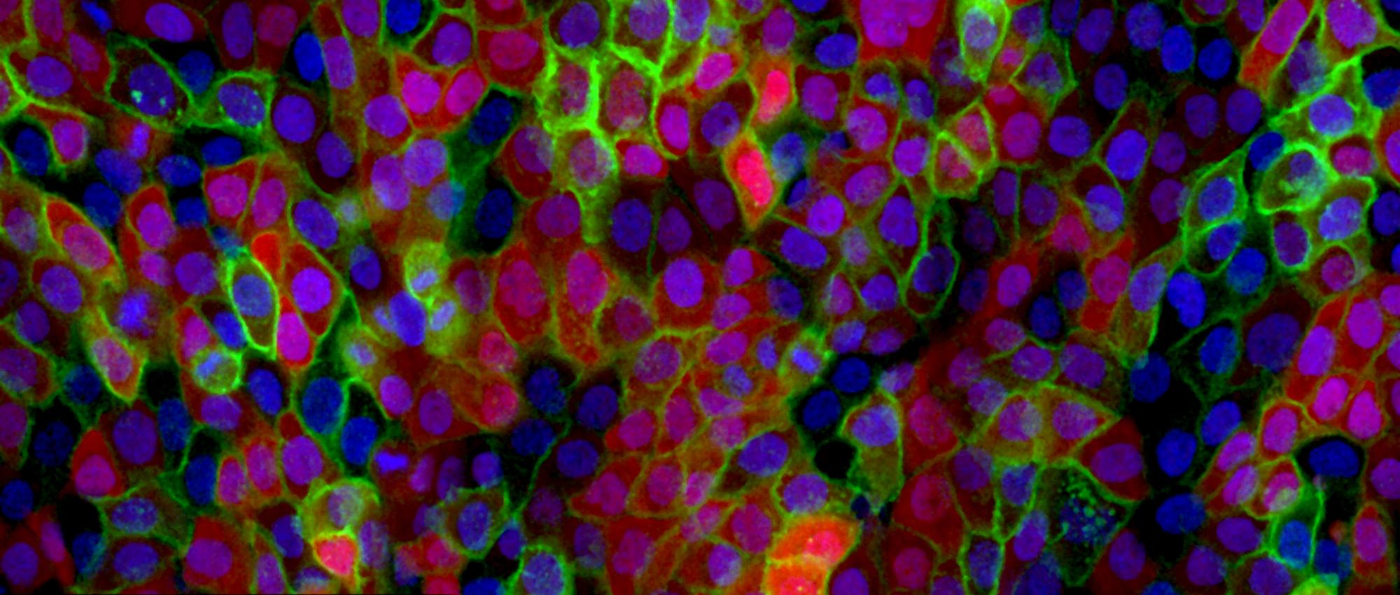 New study shows how to learn the equations of cell migration | CU ...