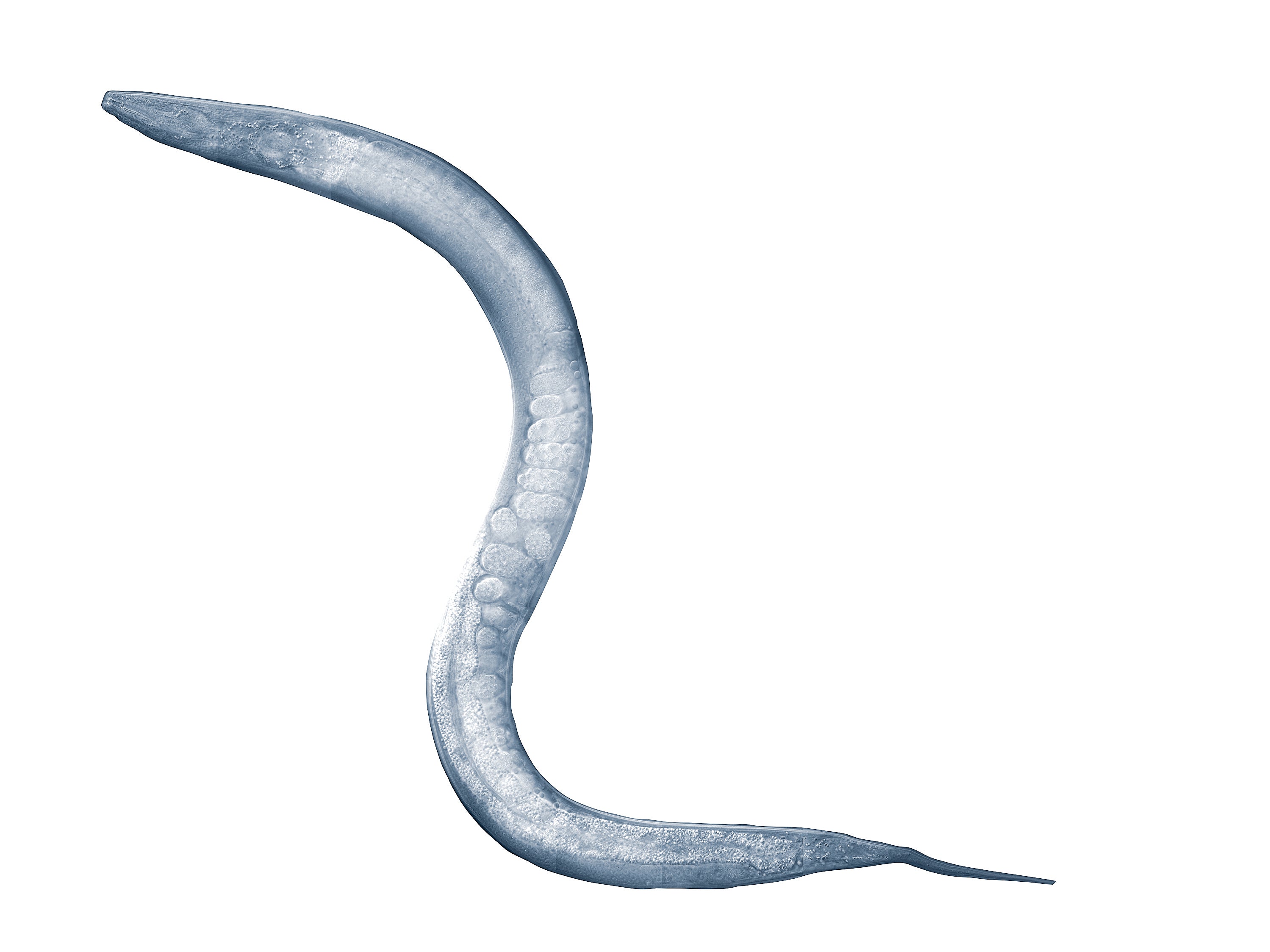 In roundworms, fats tip the scales of fertility | CU Boulder Today ...